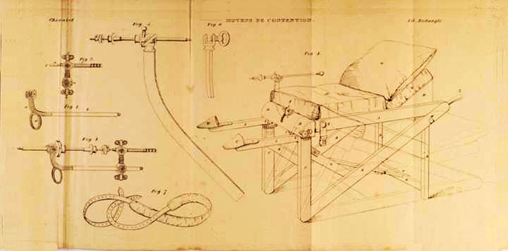 Heurteloup's Percussion Lithotrite | The British Association of ...