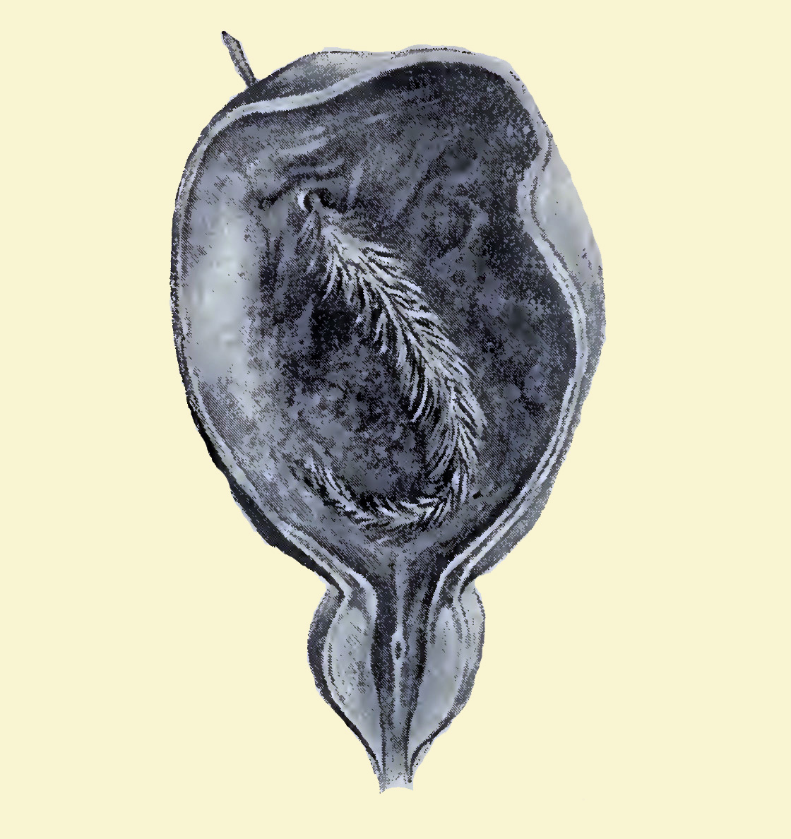 Removing Foreign Bodies | The British Association of Urological ...