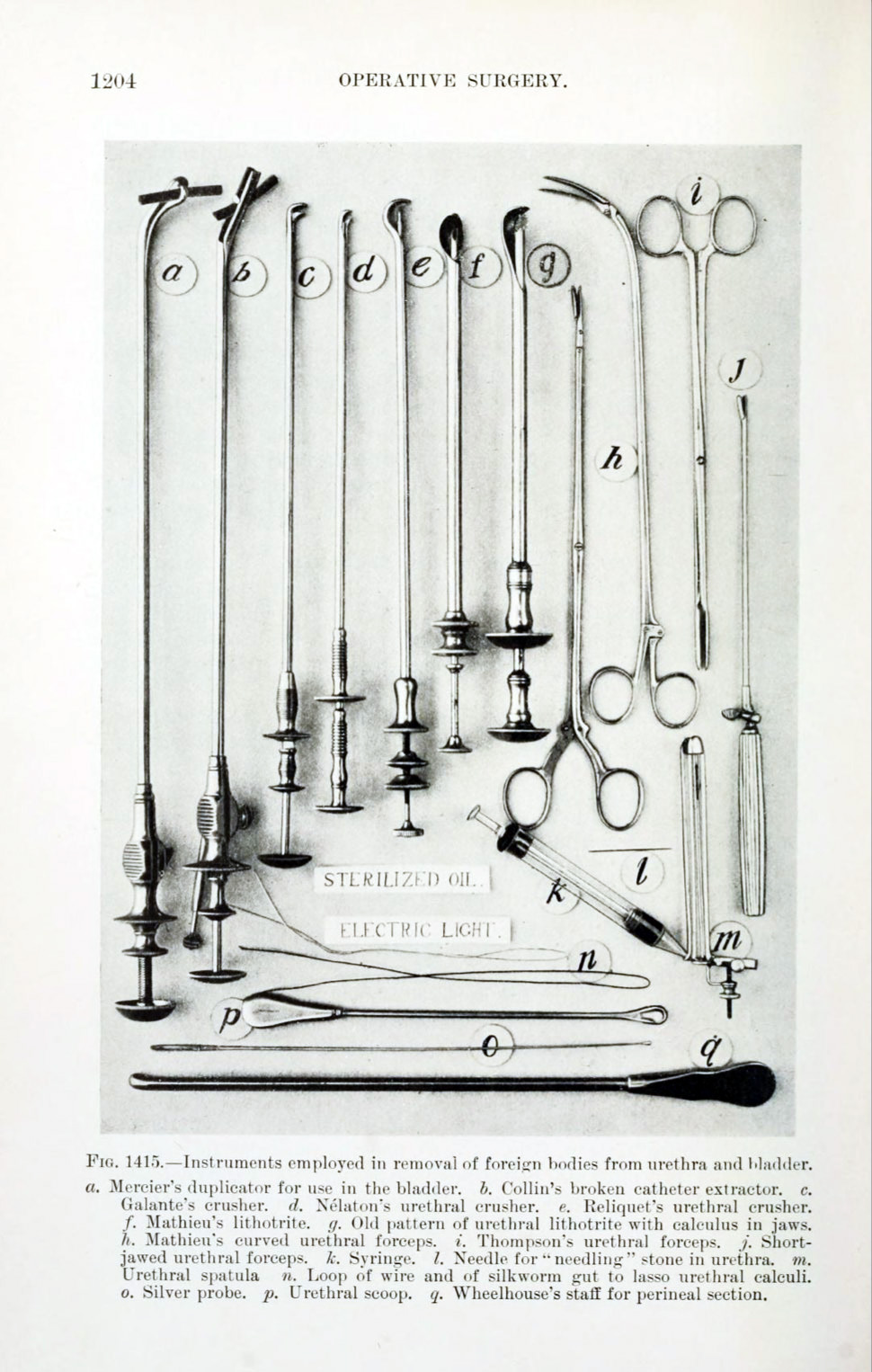 Removing Foreign Bodies | The British Association of Urological ...